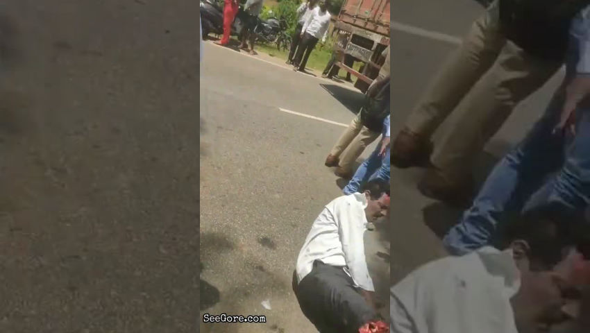 Man with a destroyed knee - GoreSee - Death is Watching over You